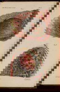 Romanticizing Death: Art in the Age of Tuberculosis