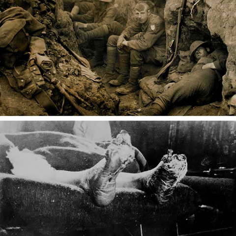 Medical Advancements Shaped by World War I