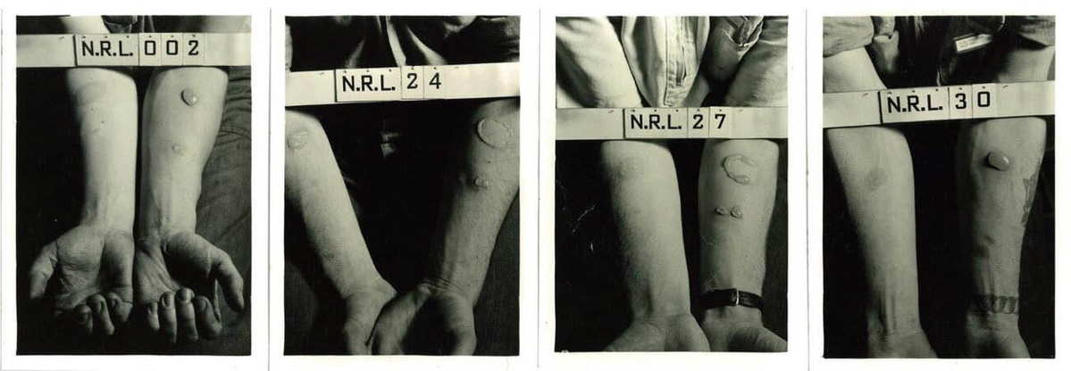 Did Nazi Human Experimentation Benefit Allied War Efforts?