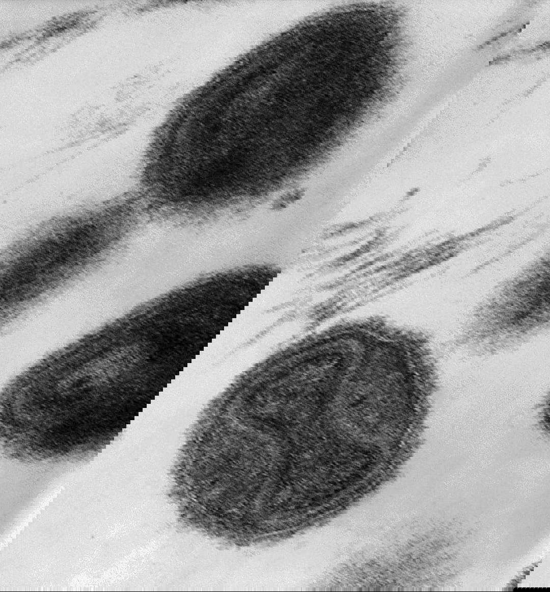 Smallpox in the New World: History, Victims, & Symptoms