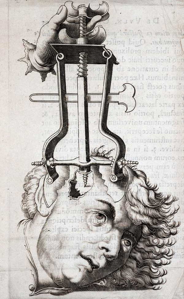 From Trepanation to Cosmetics: Mindboggling Ancient Surgeries