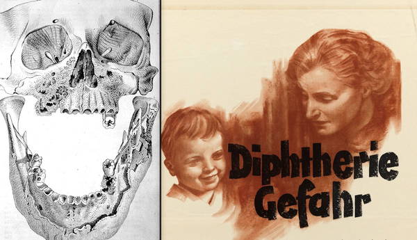 4 Diseases that Don’t Exist Anymore