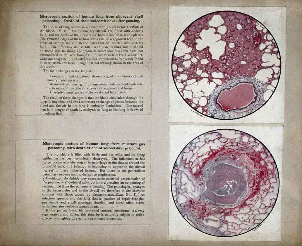 6 Crazy Examples of Biological Warfare Used throughout History