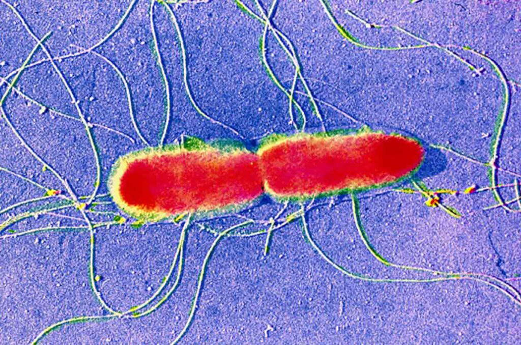 Typhoid Mary: A Trail of Scandal & Death