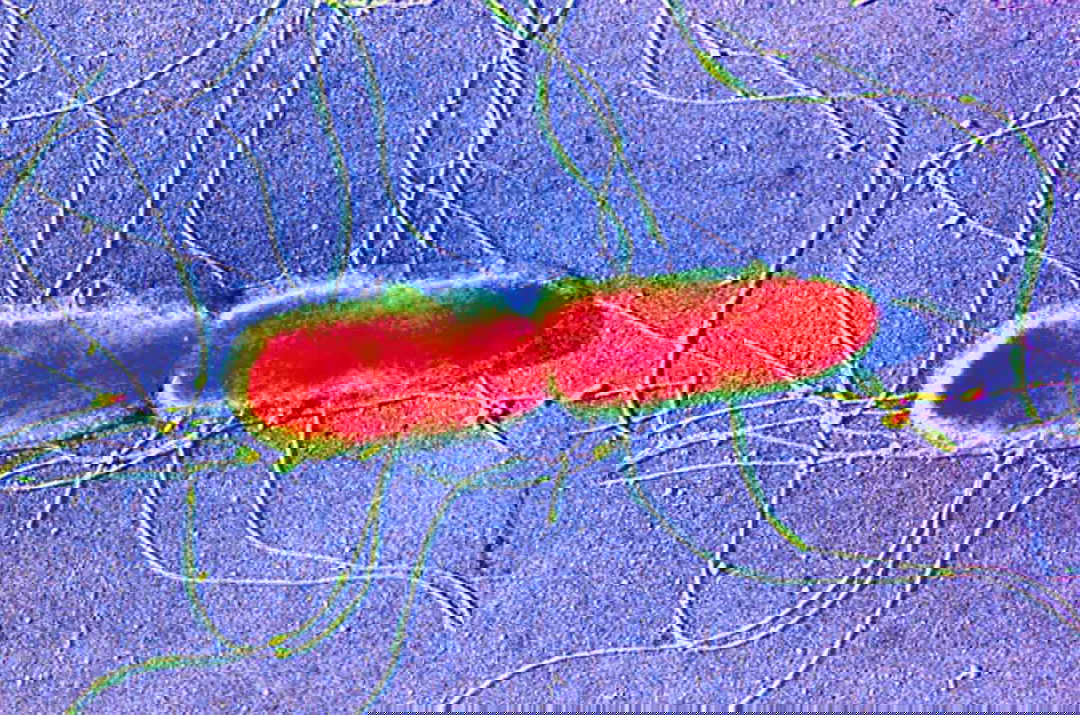 Typhoid Mary: A Trail of Scandal & Death