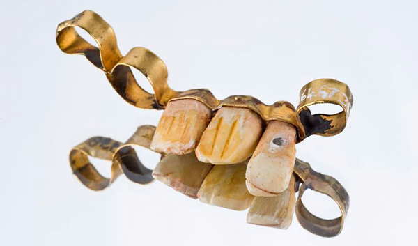 5 Ancient Roman Medical Practices Still in Use Today