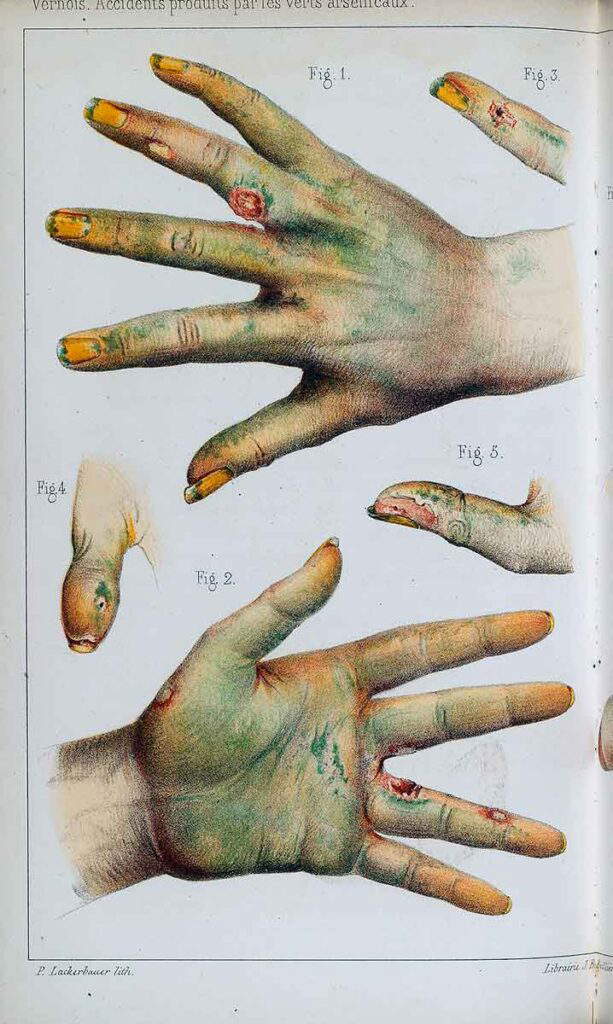 5 Victorian Fashion Trends: From Flammable Skirts to Poisonous Fabrics